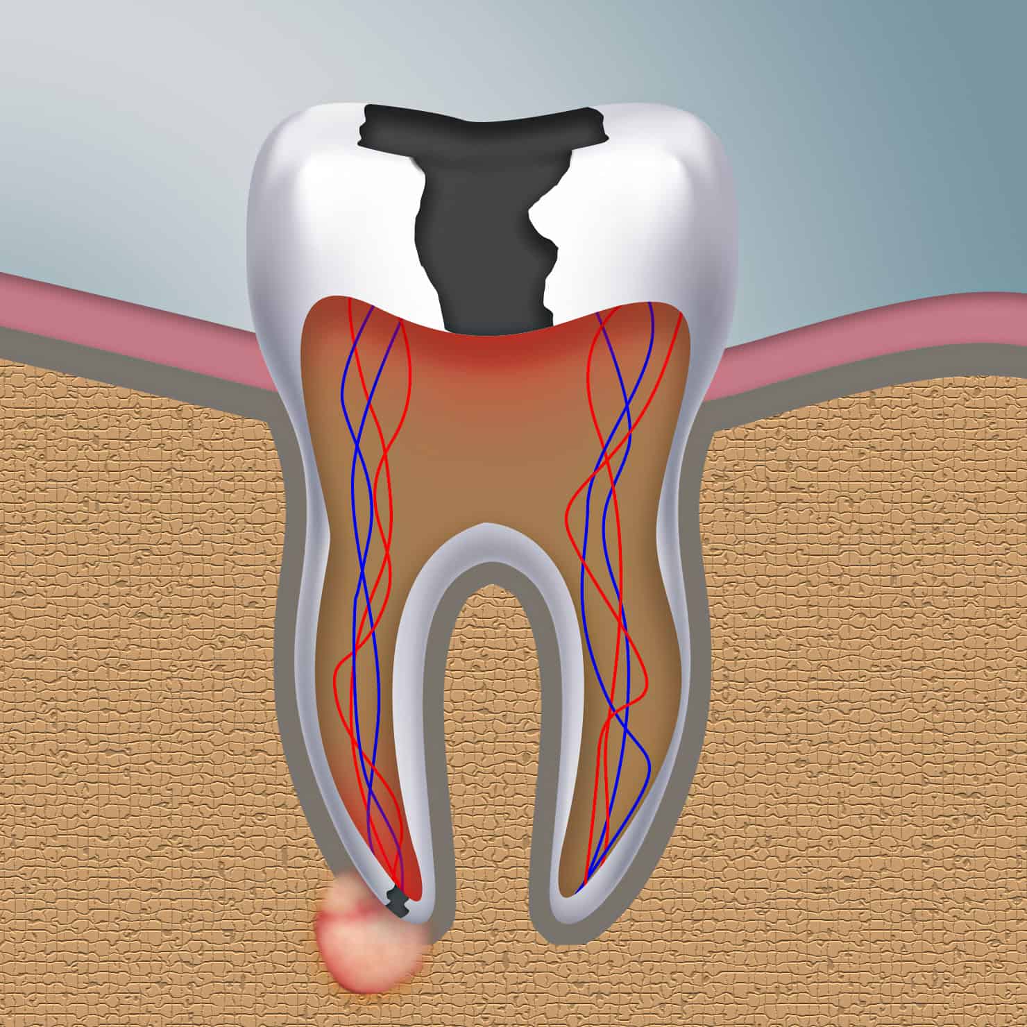 Confident Smile Makeover? Advanced Dental Procedures Here!